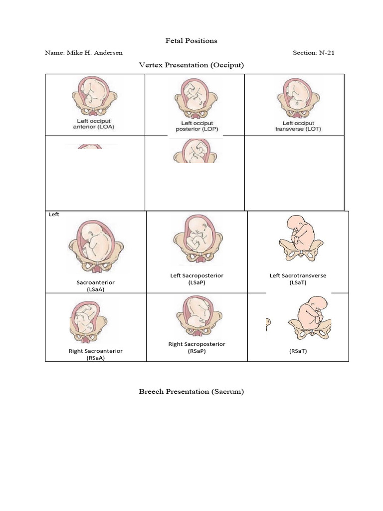 ANDERSEN Fetal Positions | PDF