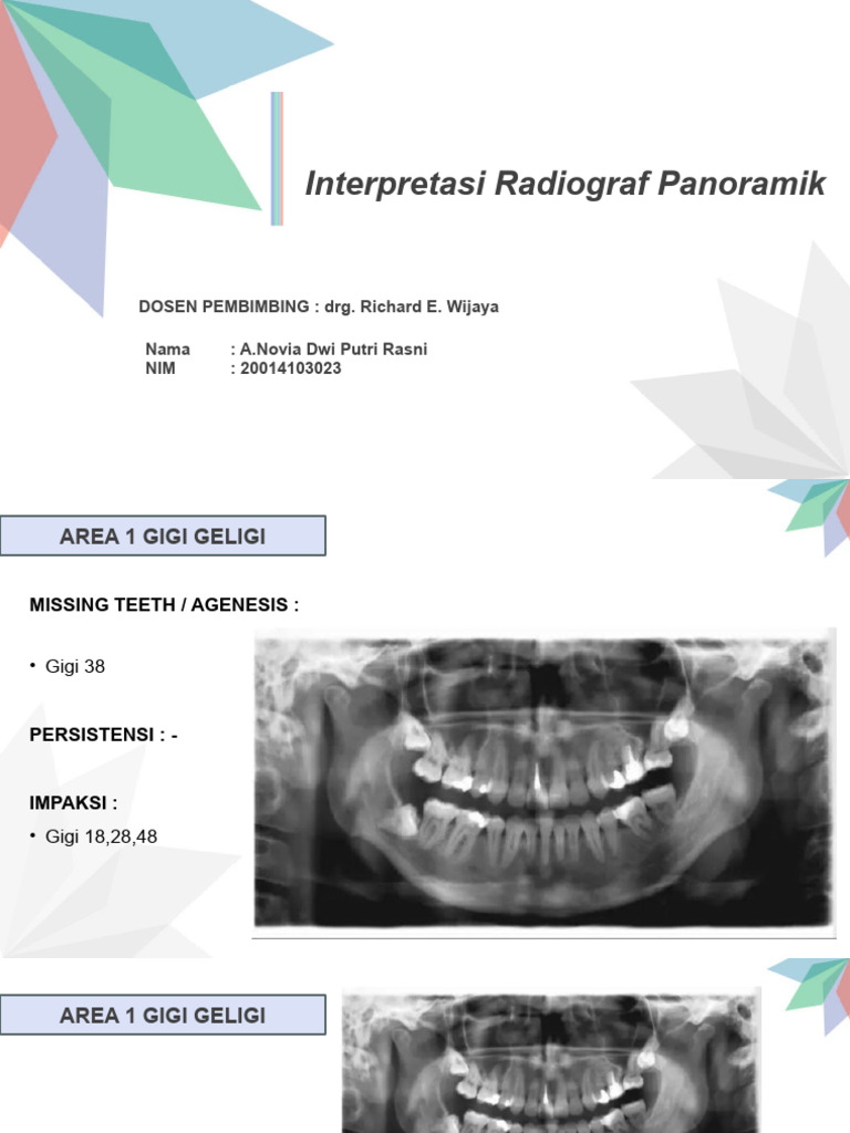 Interpretasi Radiografi Gigi Panoramik | PDF | Seni | Sains & Matematika