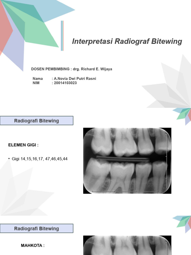 Interpretasi Radiografi Bitewing Gigi | PDF