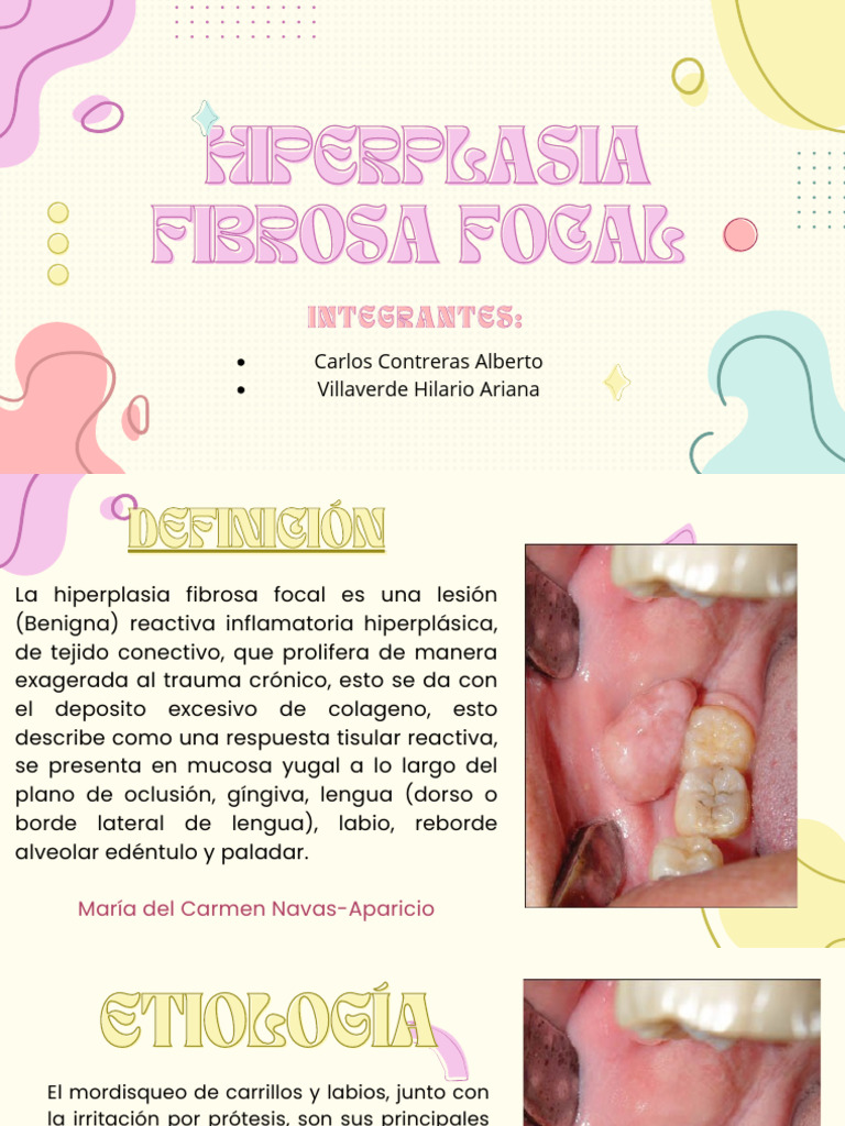 Hiperplasia Fibrosa Focal: Definición y Tratamiento | PDF | Biopsia ...