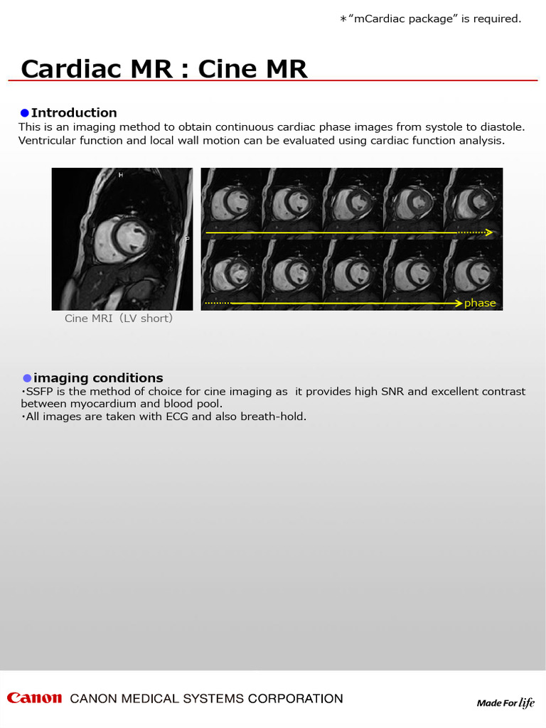 Cardiac MRI Cine Imaging Protocol | PDF | Magnetic Resonance Imaging ...