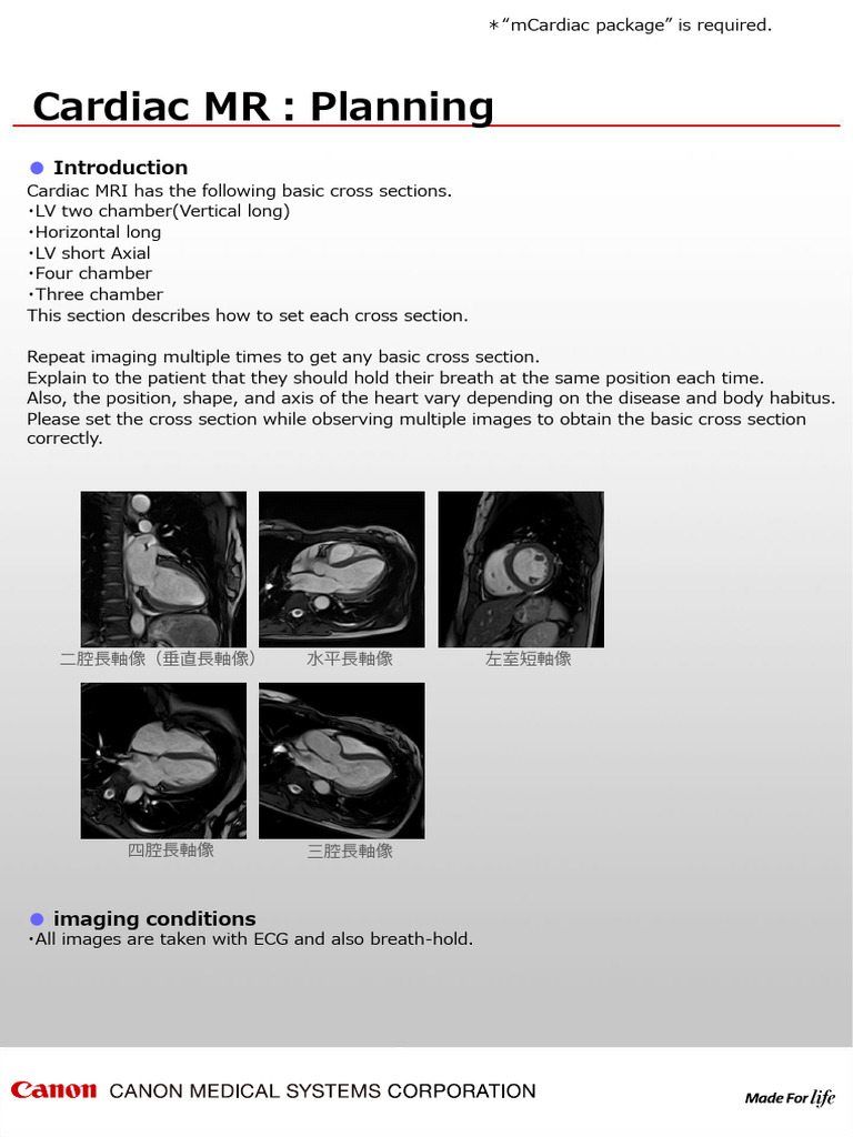 MRI protocol 637392863728765915UZ | Download Free PDF | Heart | Heart Valve