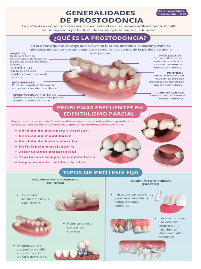 Infografía de Prostodoncia | PDF