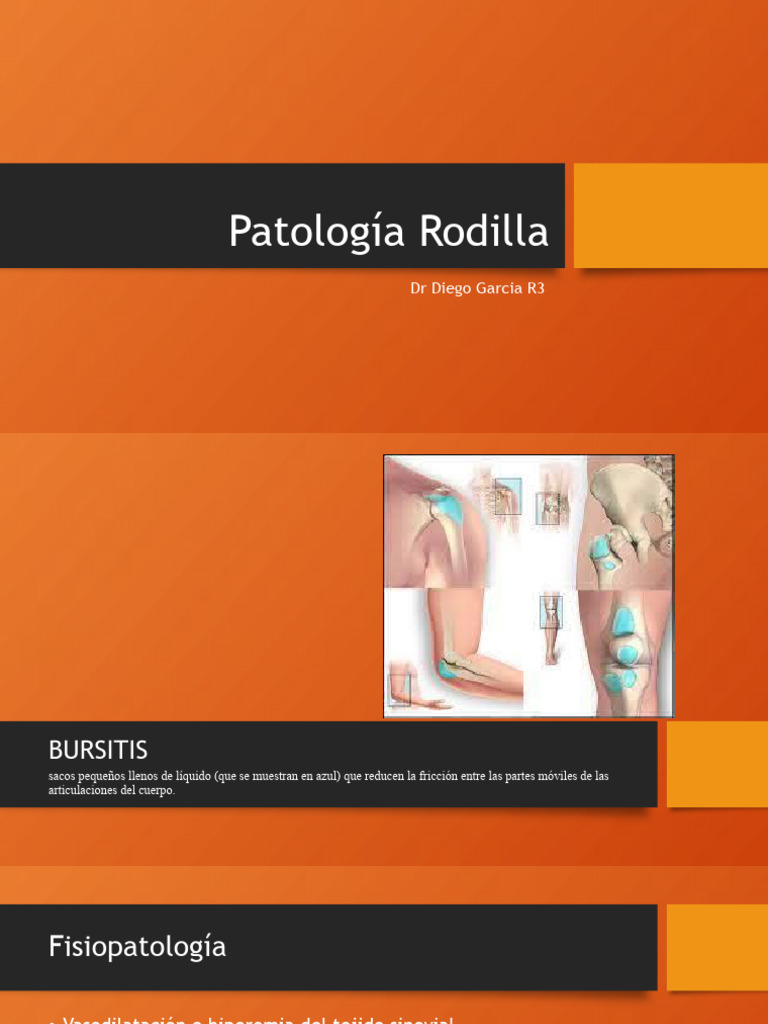 Bursitis Rodilla | Descargar gratis PDF | Rodilla | Medicina CLINICA