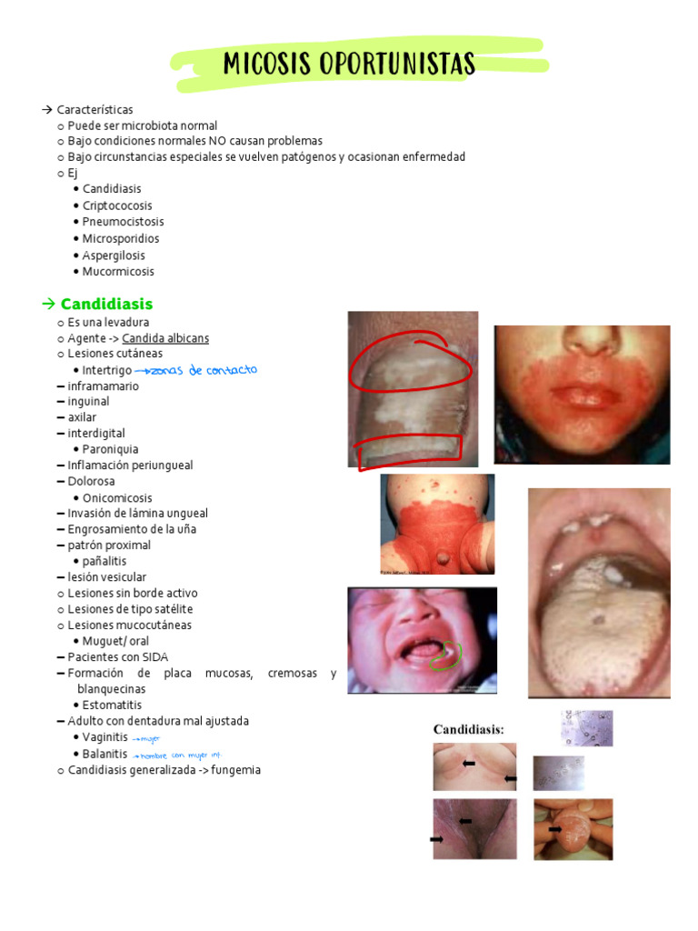 Micosis Oportunistas: Tipos y Tratamientos | PDF | Candidiasis | Micología