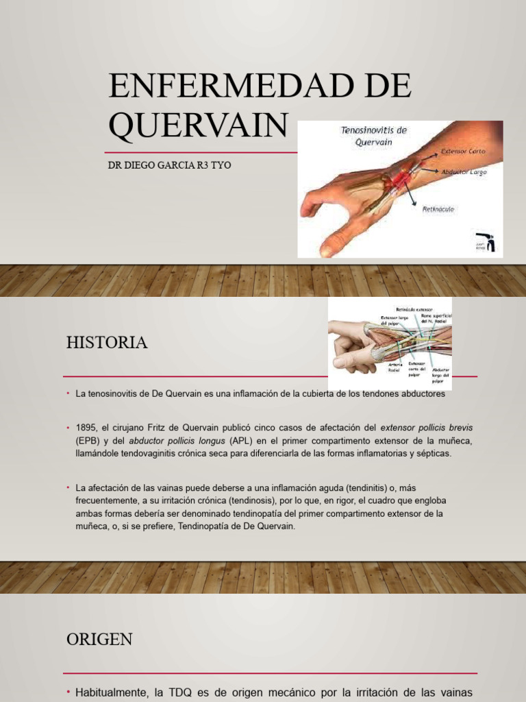 ENFERMEDAD DE QUERVAIN | Descargar gratis PDF | Causas de la muerte ...
