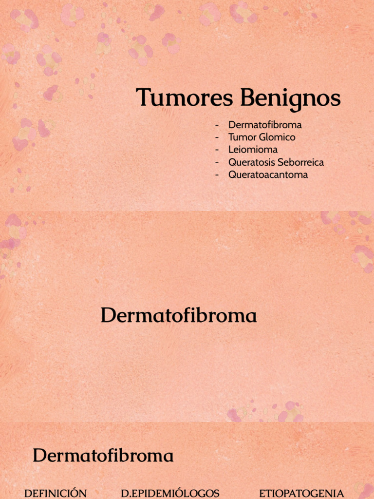 Tumores Benignos | PDF | Neoplasias | Tumor benigno