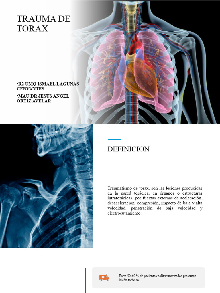 Trauma de Torax | PDF | Especialidades Medicas | Causas de la muerte