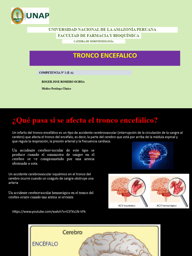 05 Tronco Encefalico | PDF | Cerebelo | Anatomía