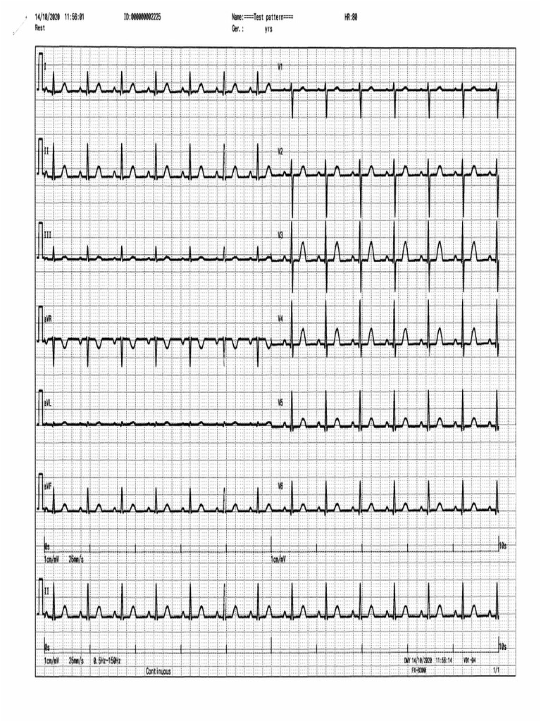 Result Report - DOM2 (+waveform Report) | PDF