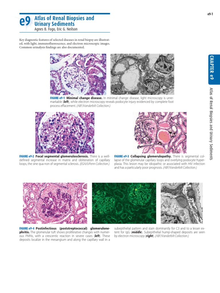 Atlas Urinary Sediments Renal Biopsies | Urological Conditions | Medicine