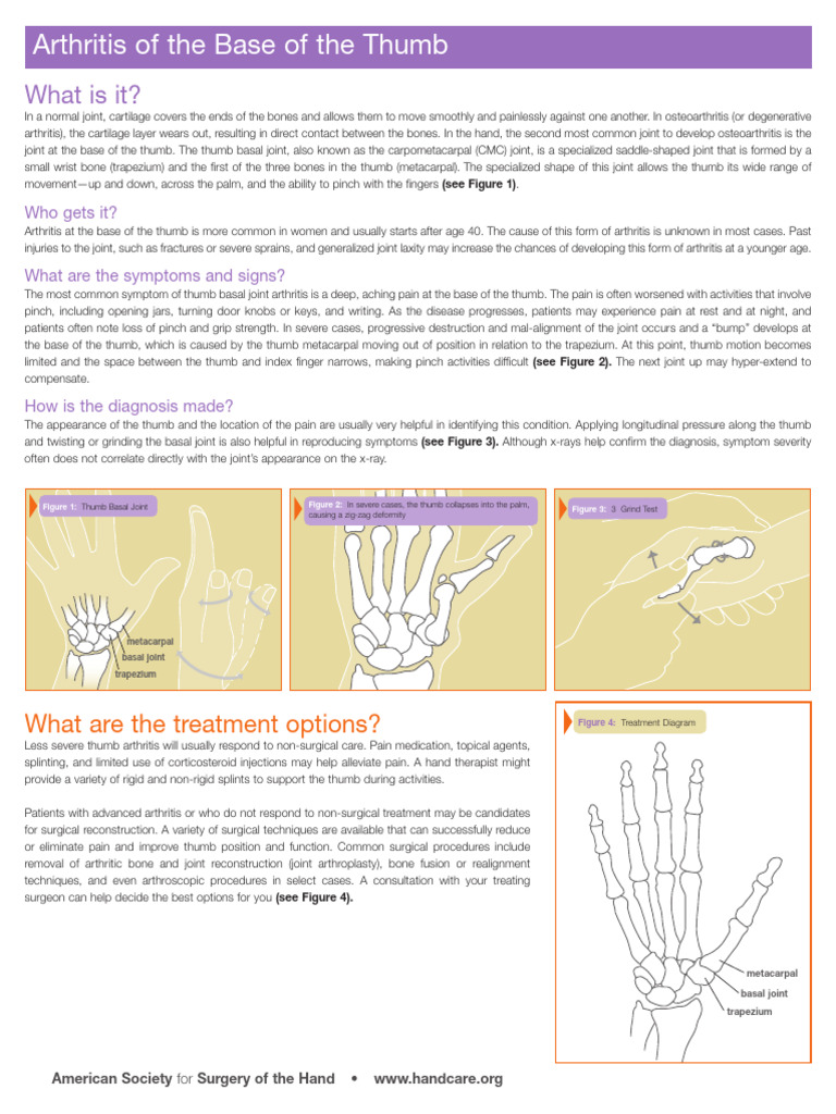 Thumb-Arthritis | PDF | Arthritis | Thumb