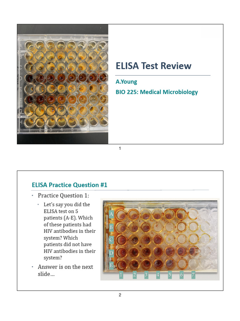ELISA Review | PDF | Elisa | Sexually Transmitted Diseases And Infections