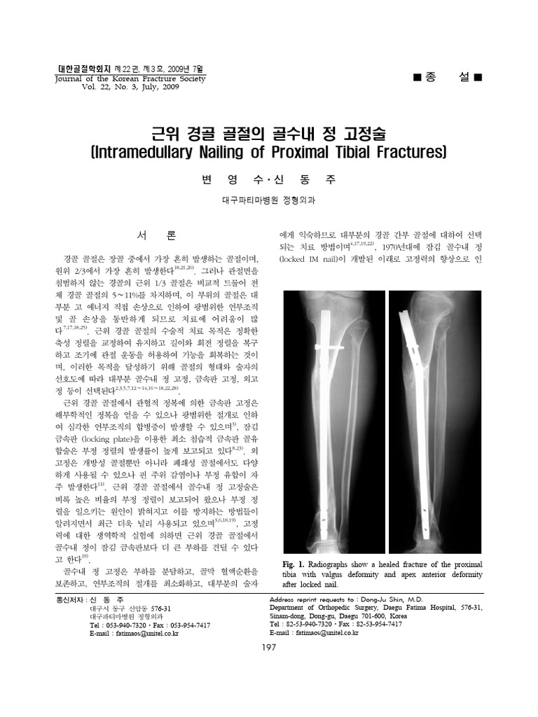 Intramedullary Nailing of Proximal Tibial Fracture | PDF