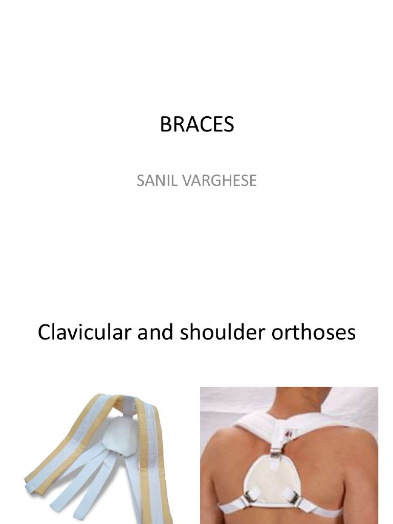 Braces | PDF