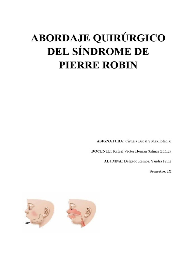 Abordaje Quirurgico Del Sindrome de Pierre Robin Sandra Delgado Ramos ...
