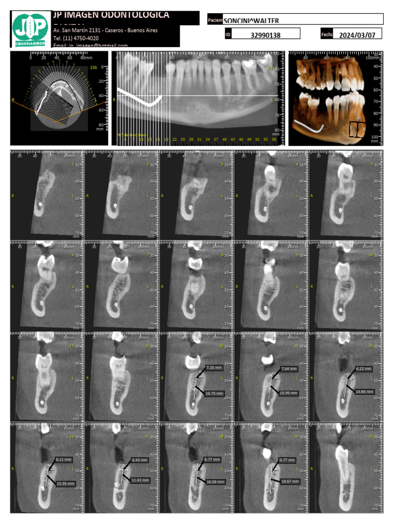 TC Soncini Water Max Inf | PDF