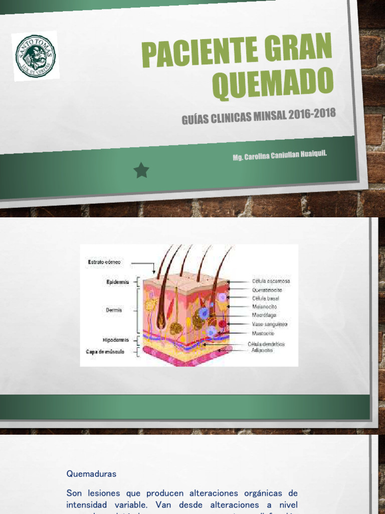 C16 Gran Quemado | PDF | Quemar | Medicina CLINICA