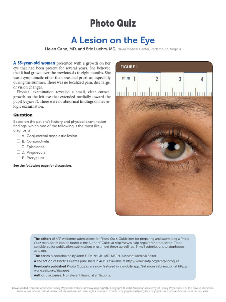 p337 | Download Free PDF | Human Eye | Ophthalmology