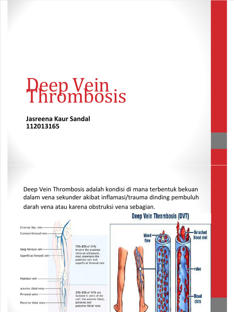 Dokumen - Tips - Deep Vein Thrombosis | PDF