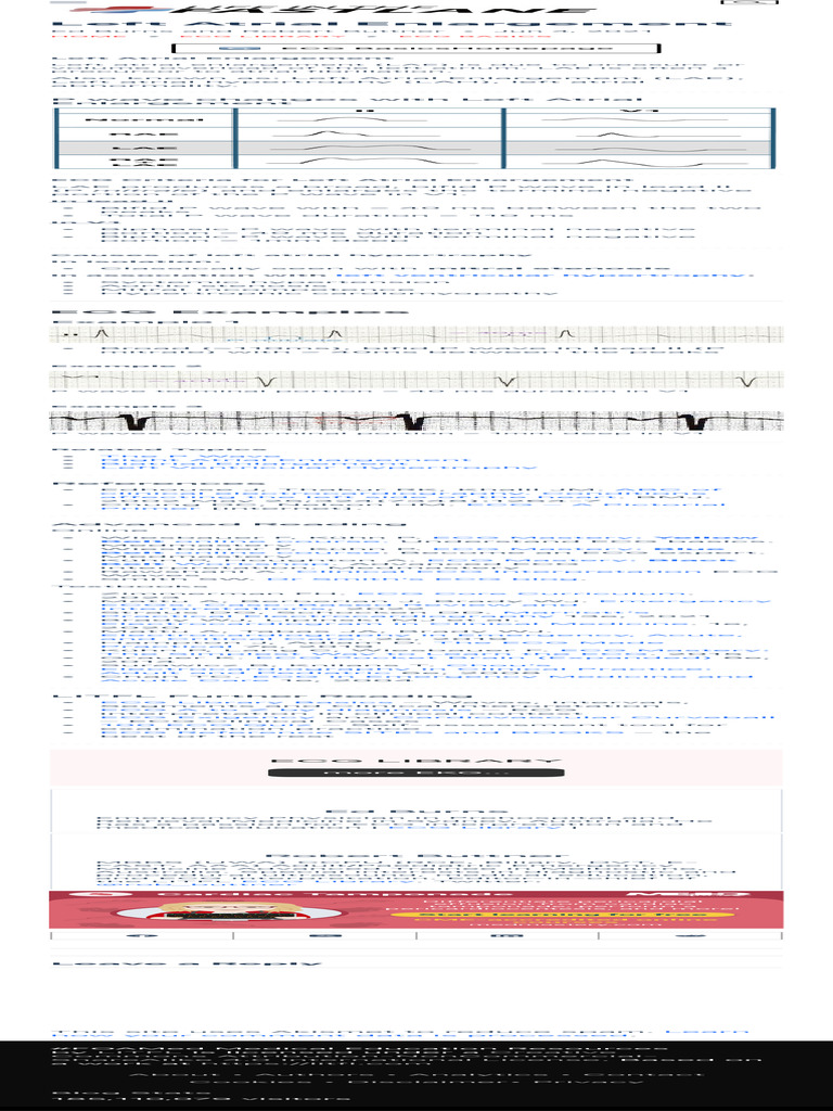 Left Atrial Enlargement - LITFL Medical Blog - ECG Library Basics | PDF | Atrium (Heart ...