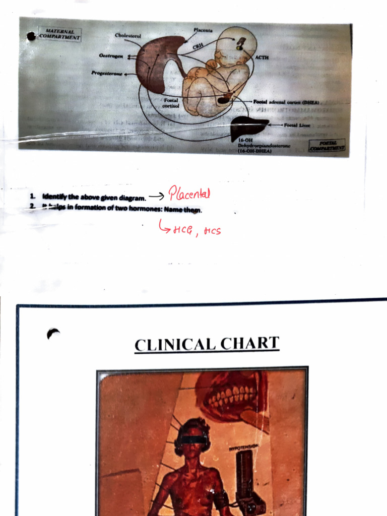 Endocrine Charts | PDF | Medical Diagnosis | Cortisol