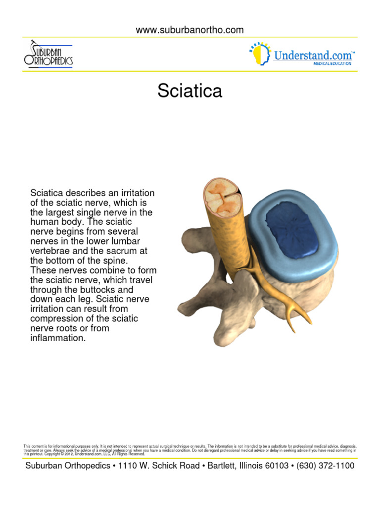 Sciatica | PDF | Diseases And Disorders | Clinical Medicine