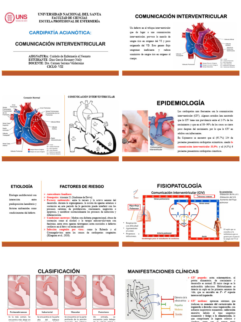 N-Up-Pdf - 3 Comunicación Interventricular Carmen | PDF | Insuficiencia cardíaca | Defecto ...