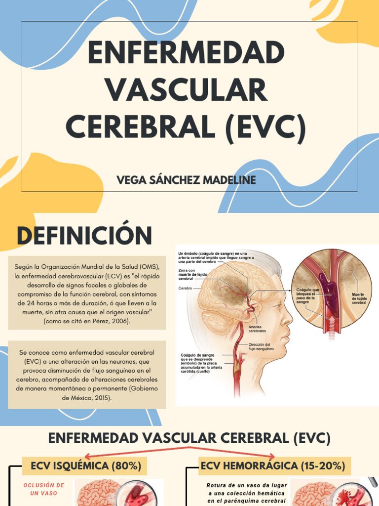 Enfermedad Vascular Cerebral (EVC) | PDF | Carrera | Sistema nervioso