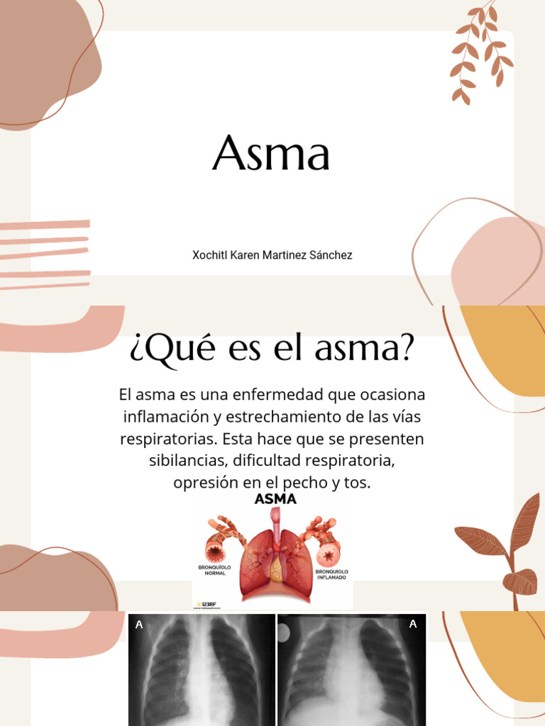 3 Presentación de Asma - 20240428 - 195729 - 0000 | PDF | Asma ...