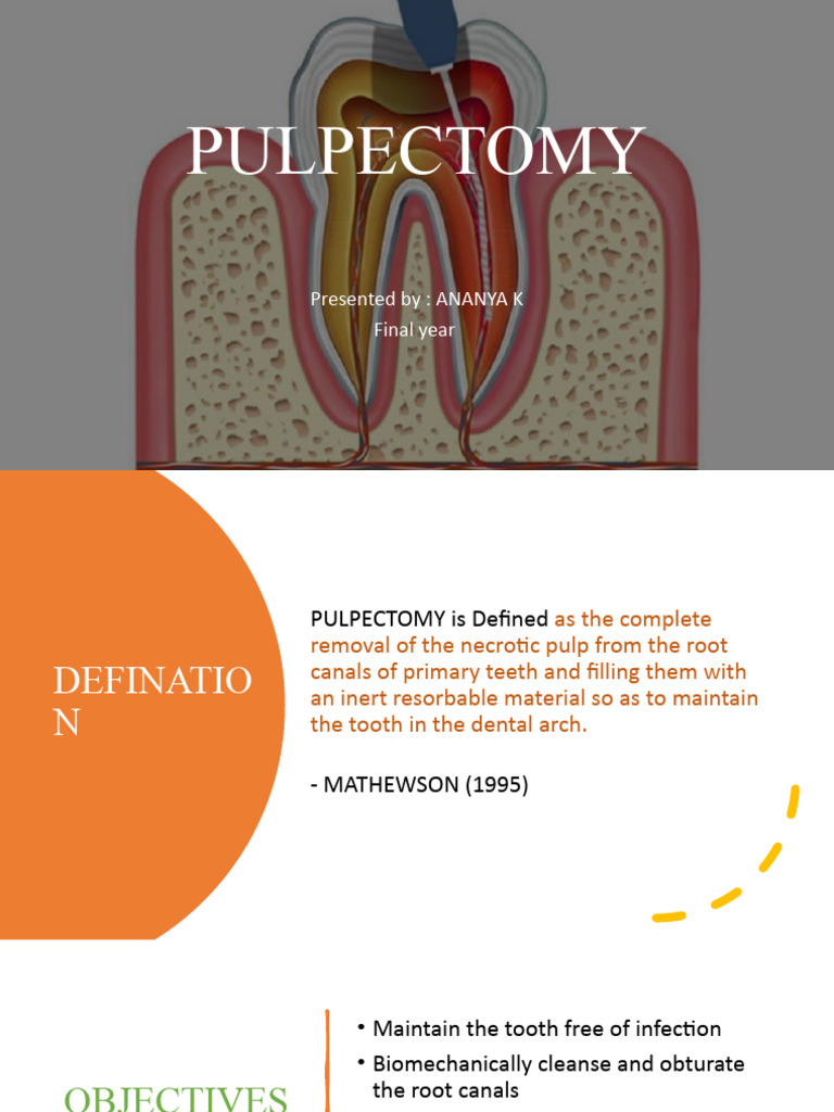 PULPECTOMY | PDF