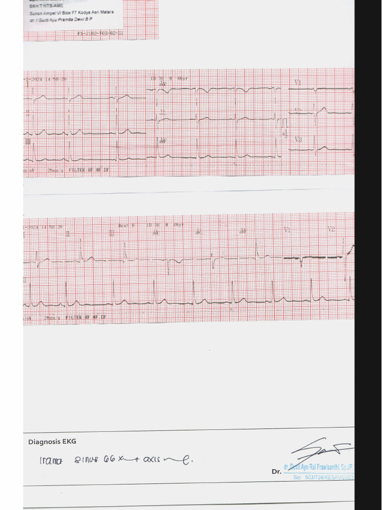 Amirullah EKG | PDF