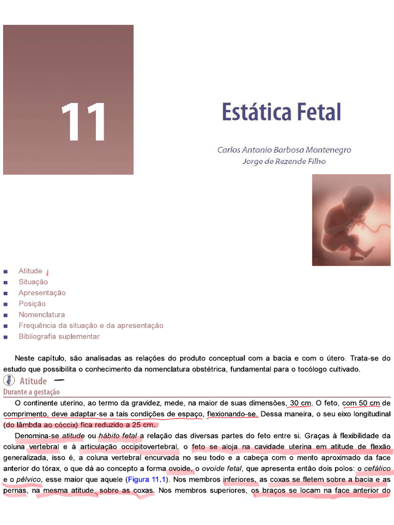 Rezende - Obstetricia 13a edic - CAPÍTULO 11- Estática Fetal | PDF