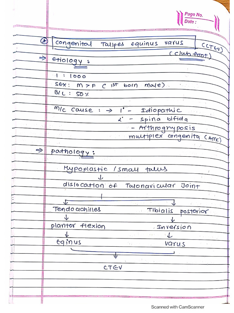 CTEV (Congenital Talipes Equino Varus) | PDF