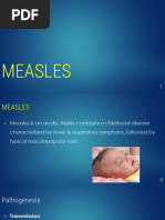 Measles Overview and Prevention Guide | PDF