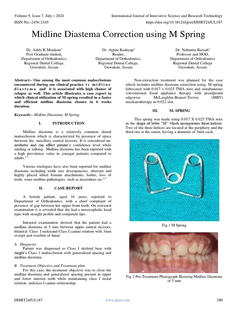 Midline Diastema Correction Using M Spring | PDF | Orthodontics | Tooth