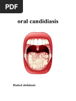 Oral Candidiasis Overview and Treatment | PDF | Candidiasis | Candida ...