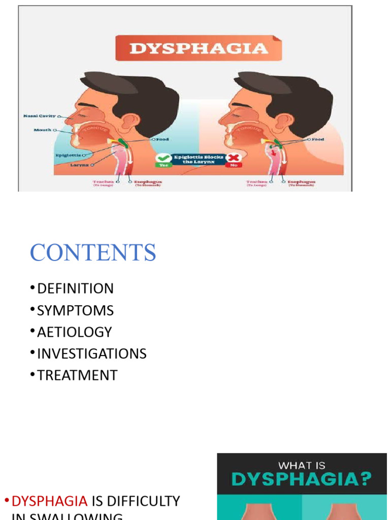 Dysphagia | PDF