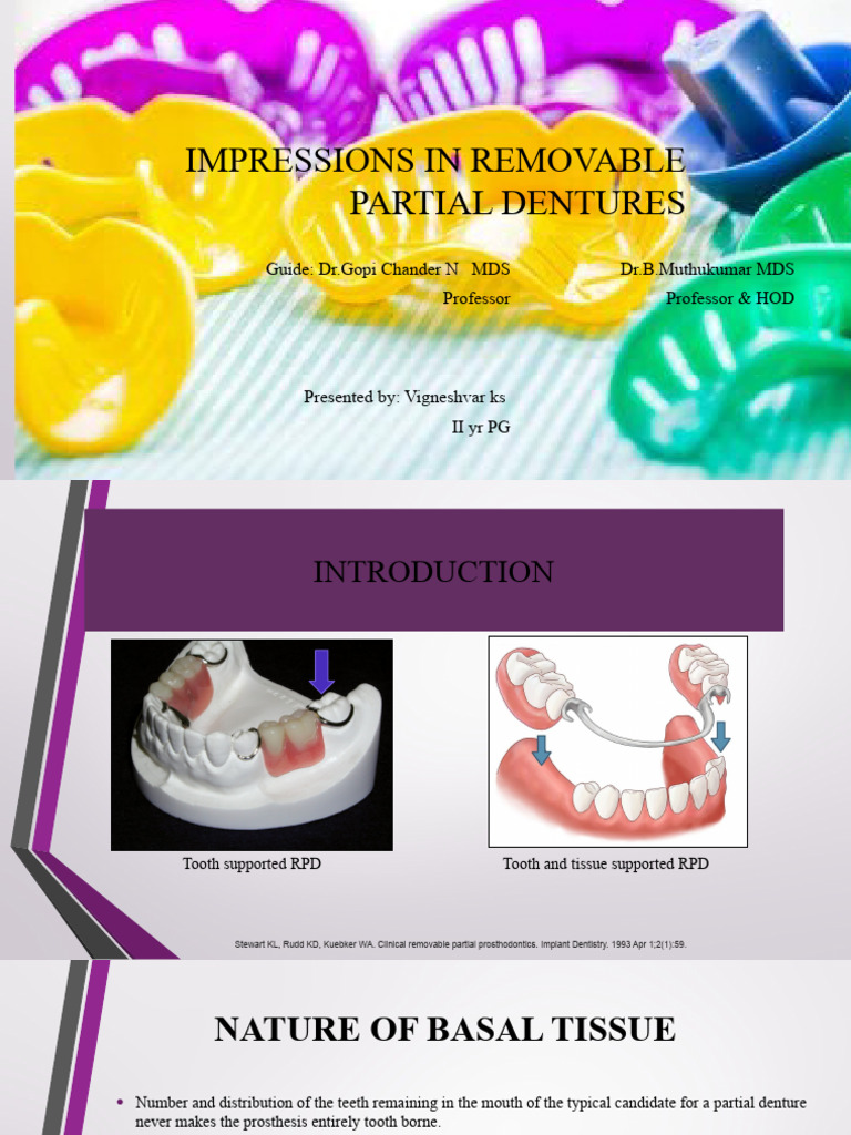 Impressions in Removable Partial Dentures | PDF | Dentures | Dental Implant
