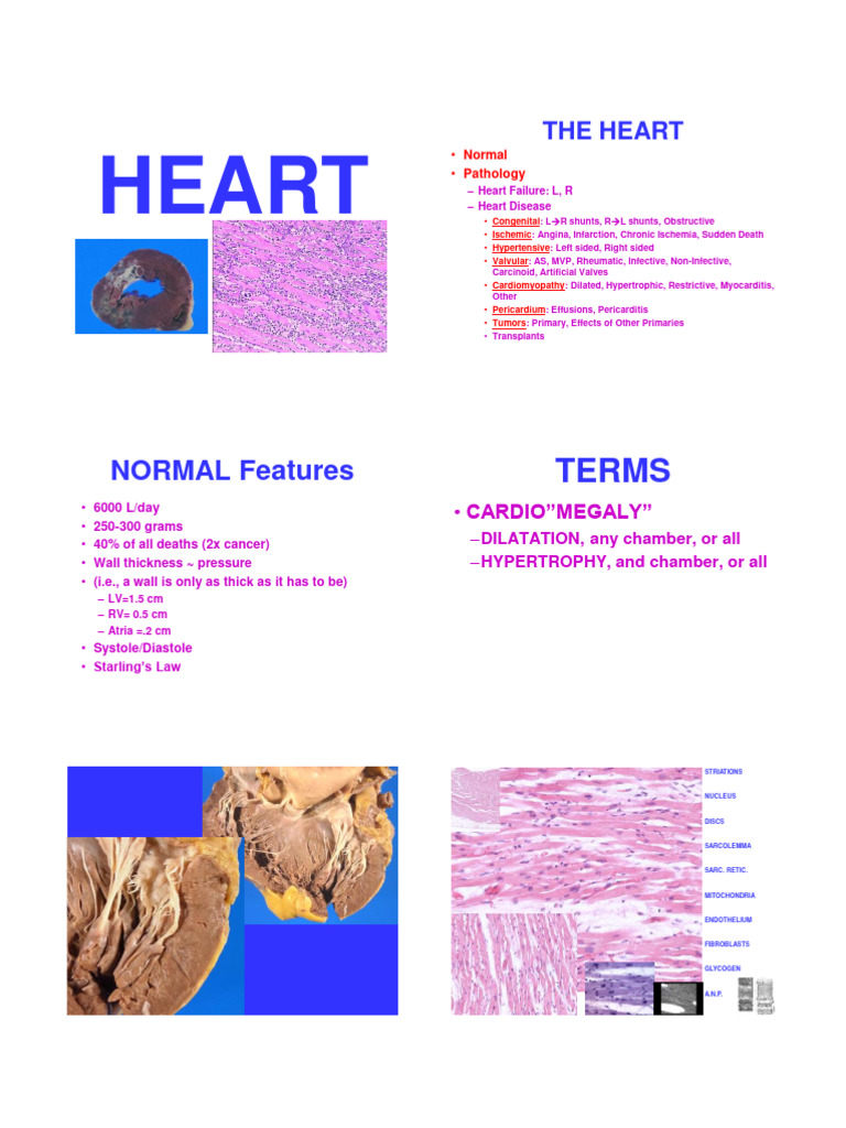 Ch12-Heart - Lecture - Cardiopulmonary Pathophysiology | PDF | Heart | Myocardial Infarction
