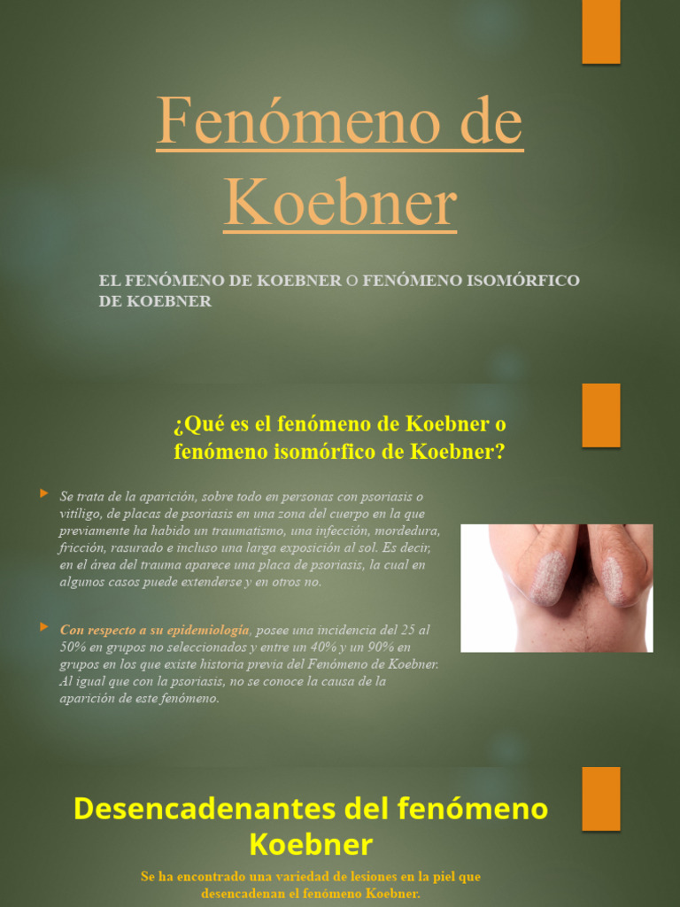 Fenómeno de Koebner | PDF | Psoriasis | Especialidades Medicas
