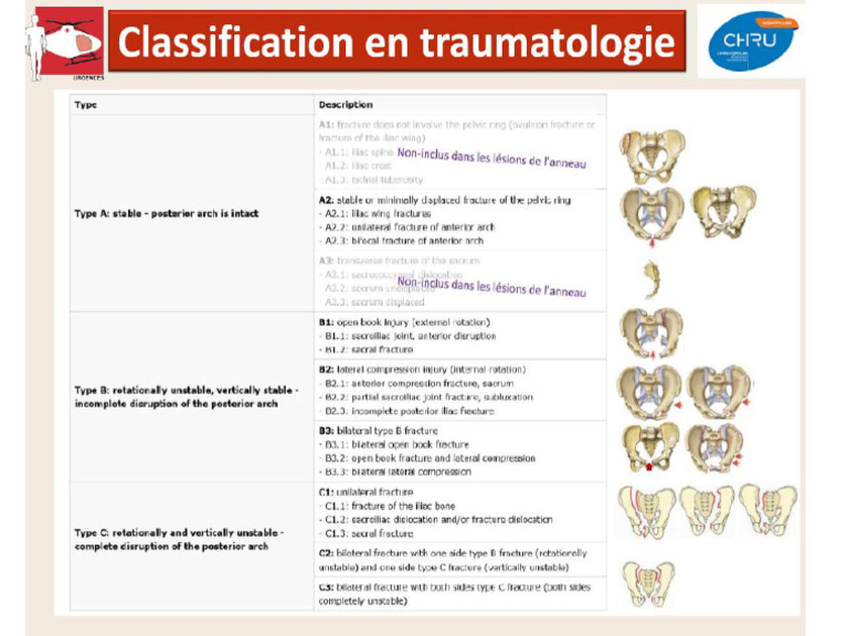 Bassin Classification Ota Tile Modifiee Des Lesions Traumatiques | PDF