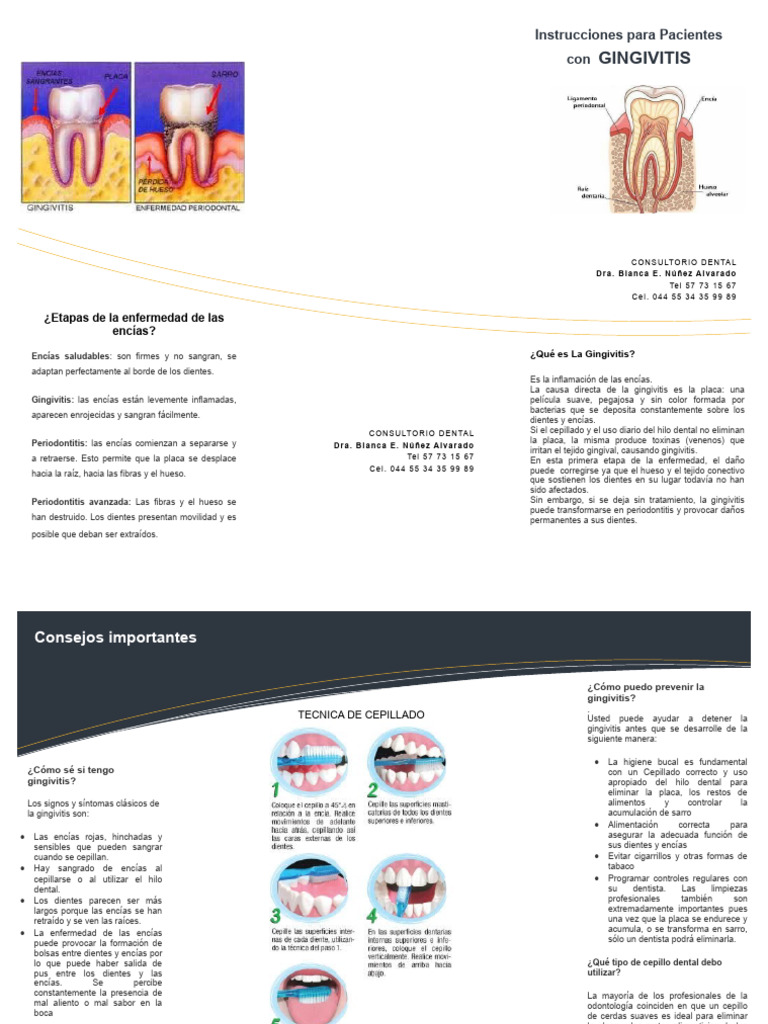 Triptico Gingivitis | PDF | Medicina CLINICA | Boca