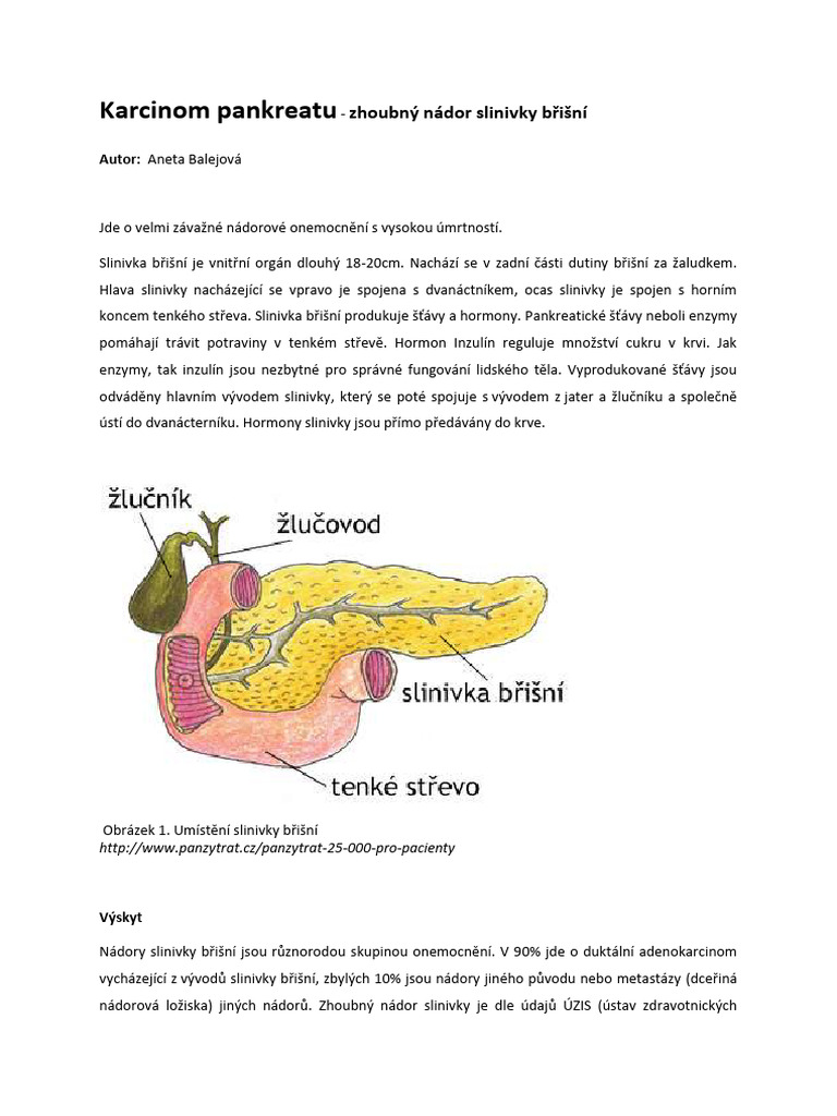 Karcinom Pankreatu | PDF
