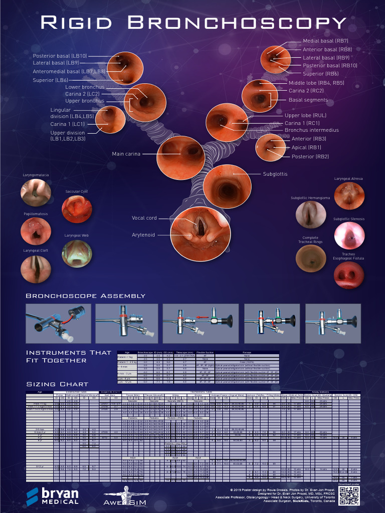 Rigid Bronchoscopy Poster | PDF | Respiratory System | Human Head And Neck
