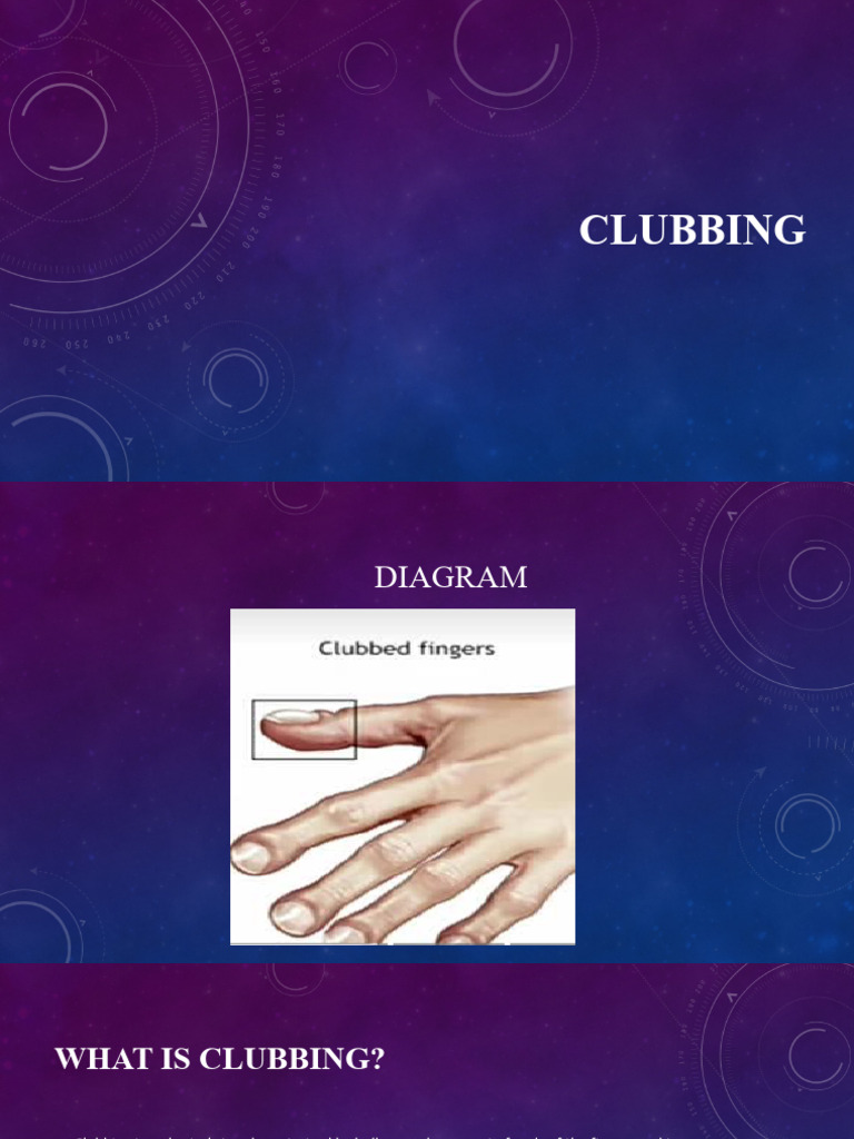 Clubbing (Medicine 2) | PDF | Respiratory Diseases | Diseases And Disorders
