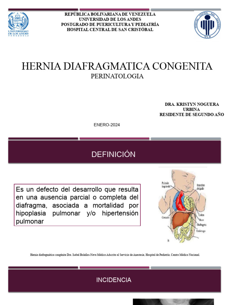 Hernia Diafragmatica | PDF | Feto | Parto