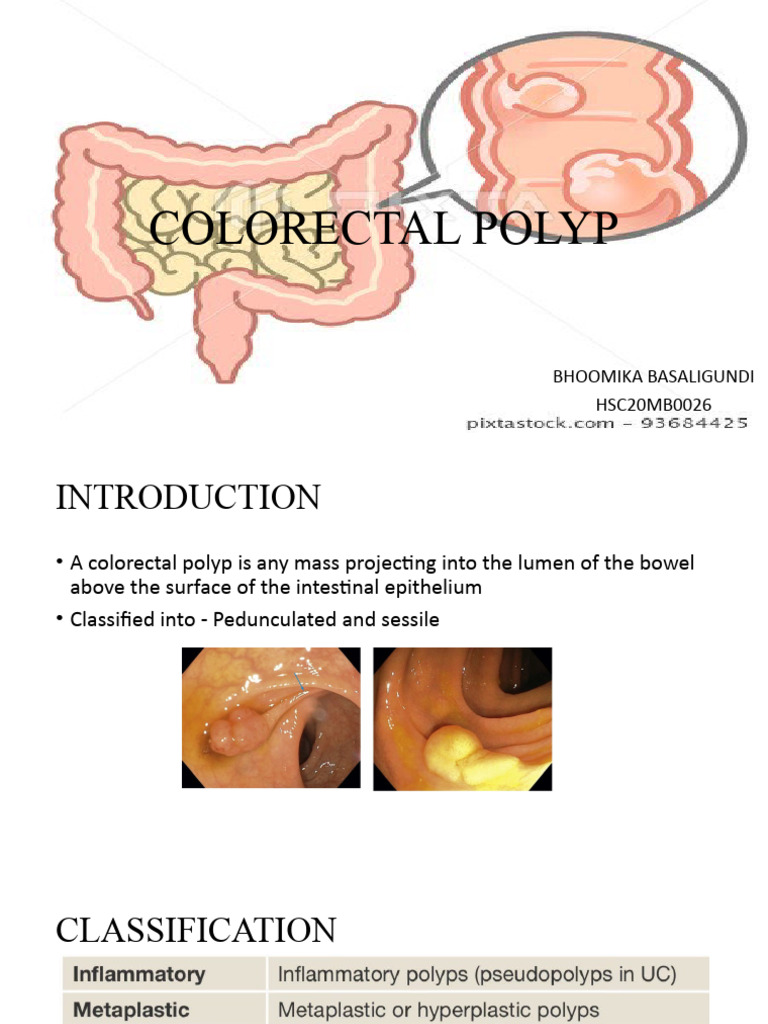 Colorectal Polyp | PDF | Adenoma | Colorectal Cancer