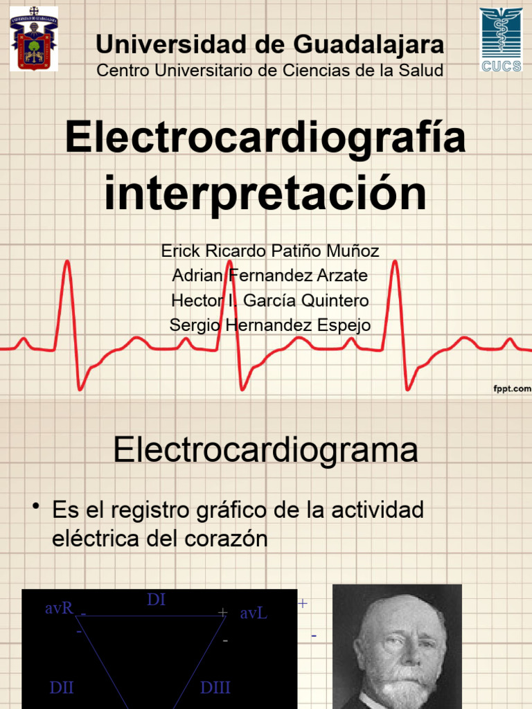 Interpretación de Electrocardiograma | PDF | Electrocardiografia | Medicina CLINICA
