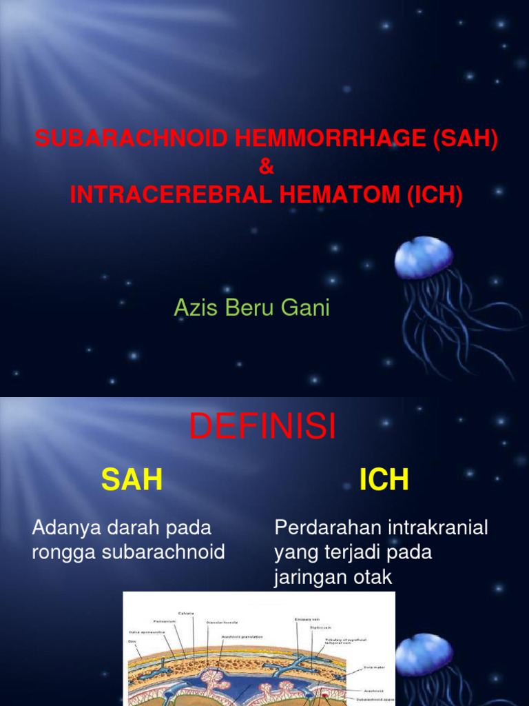 Perbandingan SAH dan ICH dalam Medis | PDF